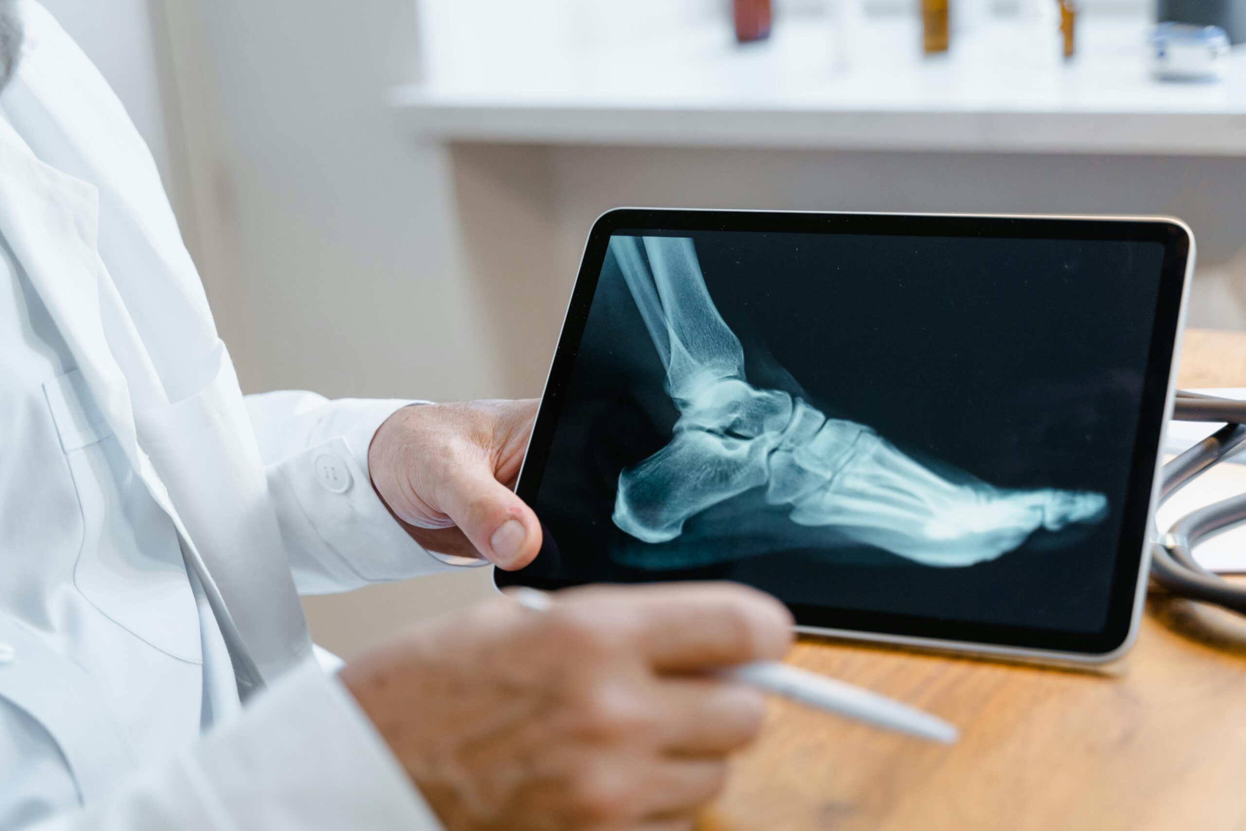 Blog chirurgie du pied | Dr Richard Borgi - Dr Richard Borgi ...